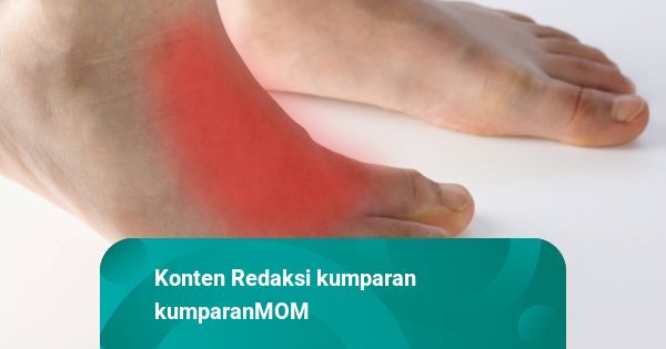 Kaki Anak Pincang saat Berjalan, Apa Penyebabnya? | kumparan.com