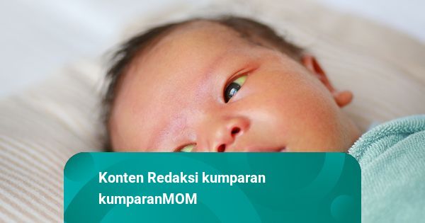 Berapa Batas Normal Bilirubin Bayi Baru Lahir? | kumparan.com