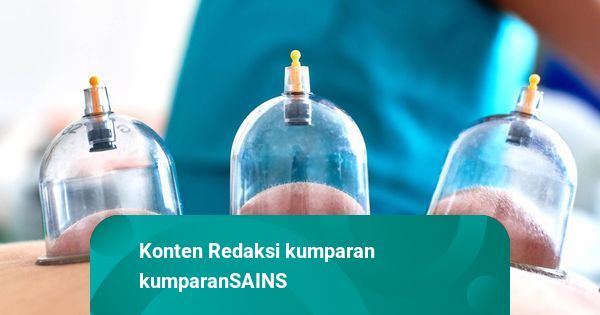 Manfaat Bekam untuk Perempuan: Regenerasi Sel Darah hingga Memperlancar ...