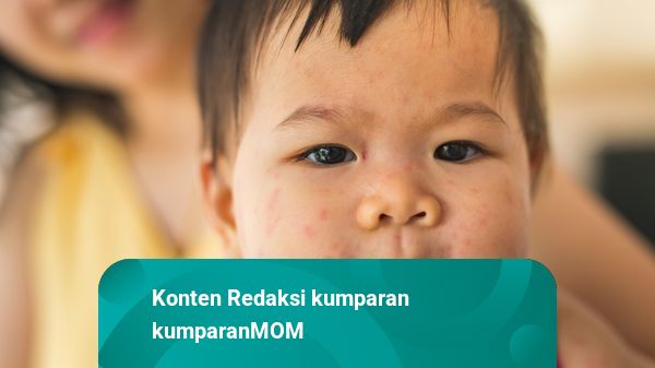 Ruam Merah Muncul di Kulit Anak setelah Demam, Bahaya Enggak Ya ...