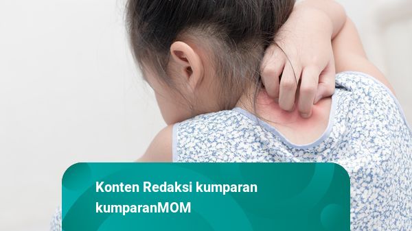 Tanda-tanda Anak Gatal karena Digigit Tungau dan Cara Menyembuhkannya ...
