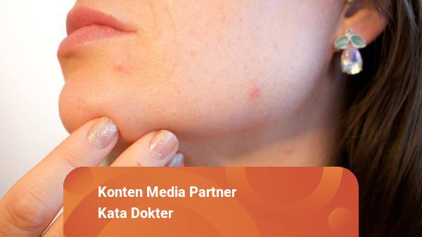 5 Cara Mengobati Bisul yang Sudah Pecah tapi Masih Keras | kumparan.com