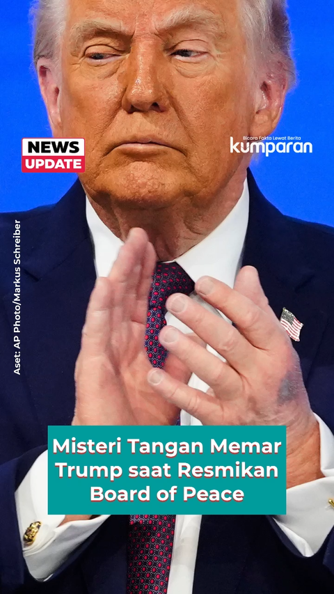 Tangan Memar Trump Disorot Saat Resmikan Dewan Perdamaian