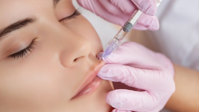 Hal yang Perlu Diperhatikan saat Ingin Lepas Filler Bibir | kumparan.com