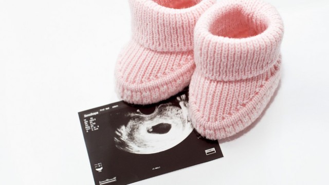 Cara Membaca Hasil Foto USG (Ultrasonografi) | kumparan.com