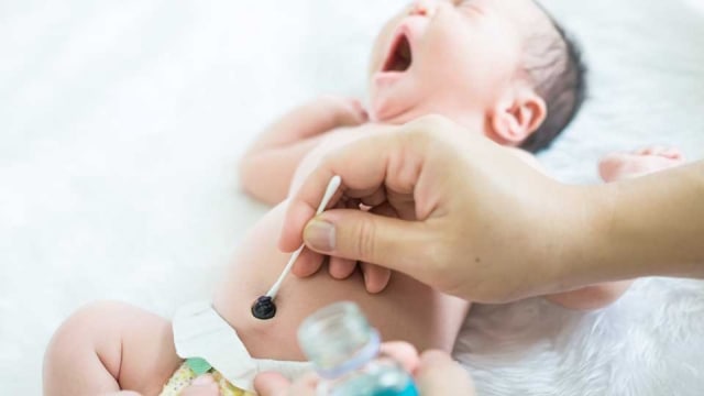 Ciri-Ciri Infeksi pada Tali Pusat Newborn dan Cara Merawatnya ...