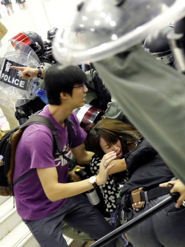 Bentrok di Mal, Telinga Politisi Hong Kong Digigit Hingga Putus ...