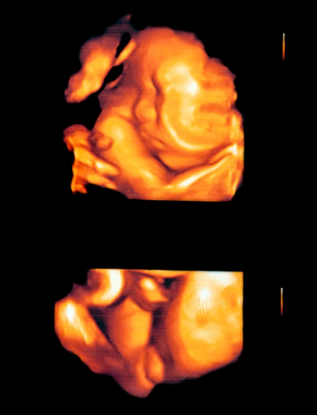 Daftar RS di Bekasi yang Menyediakan USG 4D Beserta Tarifnya | kumparan.com