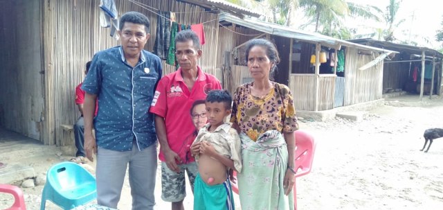 Constantino, Bocah asal NTT yang 11 Tahun Hidup Tanpa Anus, Akan Dibawa ...