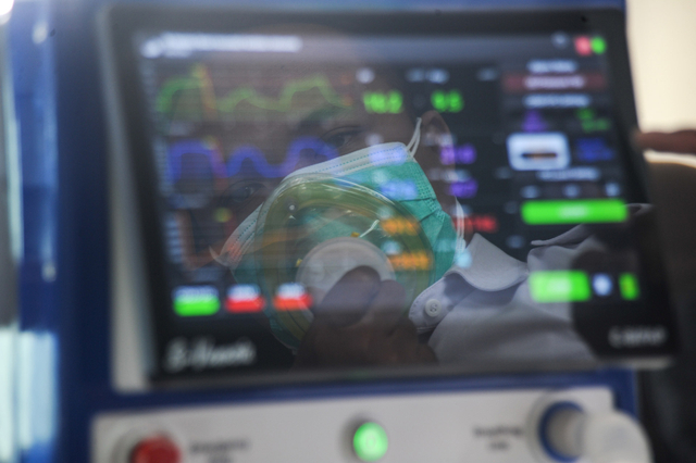 Tekan Impor, Industri Alat Kesehatan RI Produksi Ventilator-Mesin ...