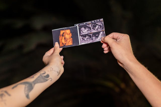 Arti BPD dalam USG Lengkap dengan Cara Membaca Hasilnya dengan Benar ...