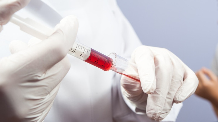 Cara Baca Hasil Pemeriksaan Hematologi Rutin dengan Mudah | kumparan.com