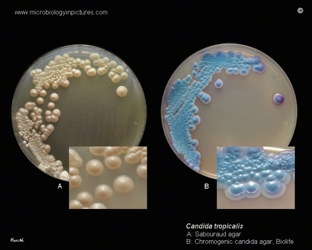ISOLASI DAN IDENTIFIKASI FUNGI PENYEBAB MIKOSIS OPPORTUNISTIK ...