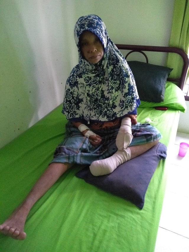 Kisah Pasien Korban Perokok Pasif Yang Membuat Tubuhnya Membusuk ...