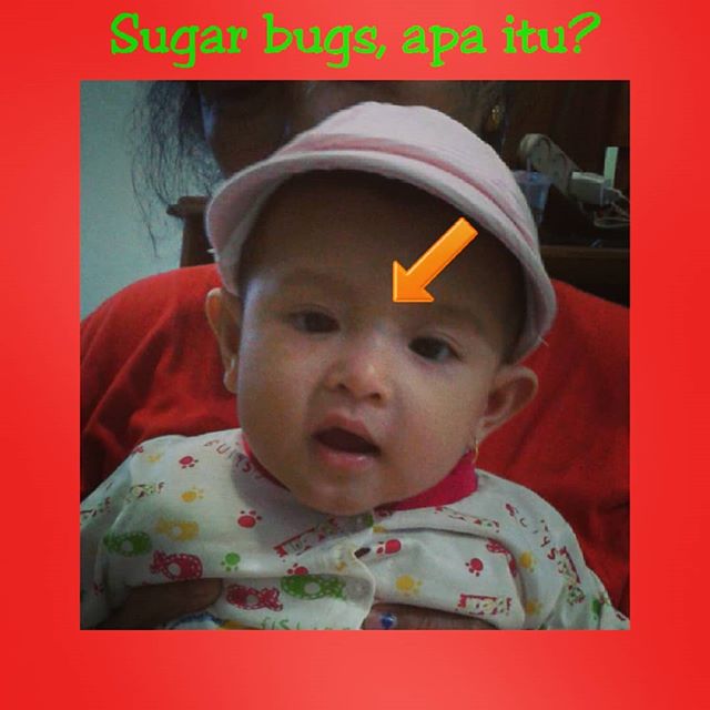 Sugar Bugs? Apa Itu? | kumparan.com