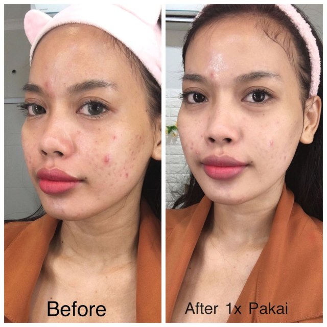 Review Moisturize Rose Jelly Mask By Eileen Grace. | kumparan.com