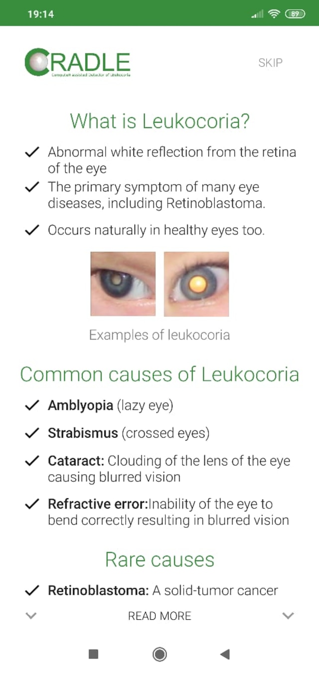 Peneliti Ciptakan Aplikasi yang Bisa Deteksi Kanker di Mata Anak ...