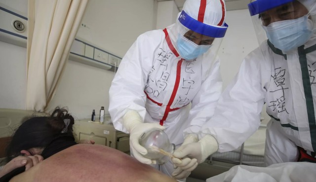 Foto: Bekam dan Akupuntur Solusi Alternatif Pengobatan Corona di China ...