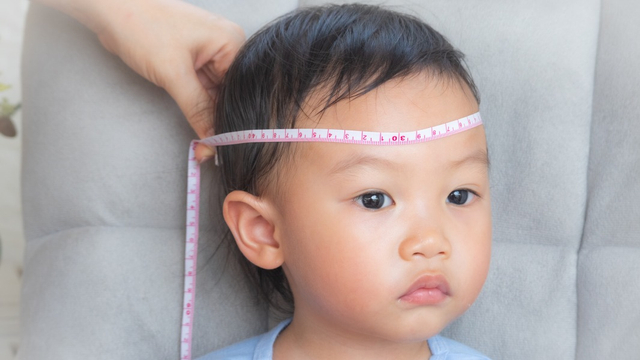 Mengukur Lingkar Kepala Anak, Apa Gunanya? | kumparan.com