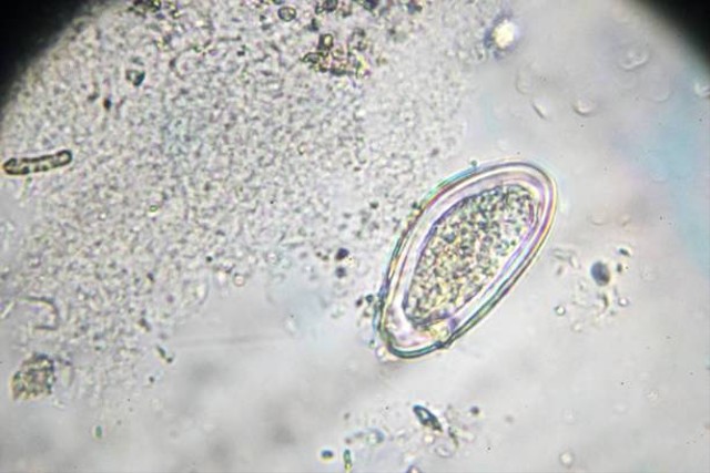 Platyhelminthes Pengertian Ciri Ciri Dan Klasifikasi Kelasnya