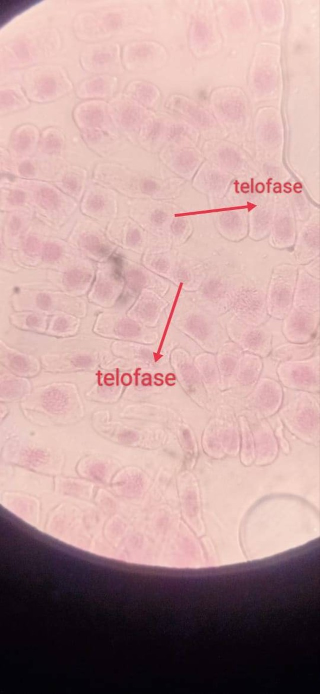 Pembelahan Mitosis Pada Akar Bawang Bombai (Allium cepa. L) | kumparan.com
