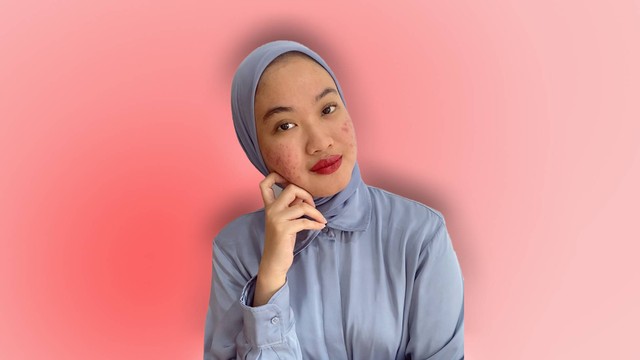My Beauty Routine: Merawat Jerawat ala Skincare & Makeup Enthusiast ...