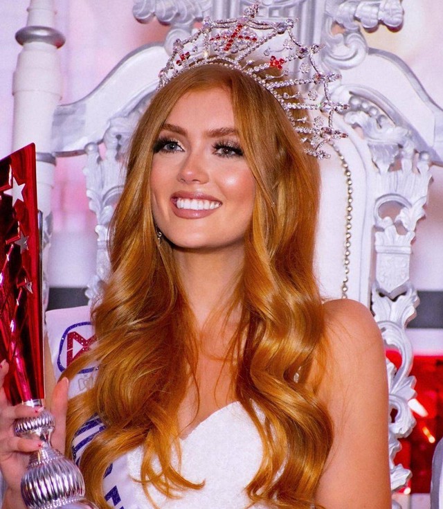Dulu Dirundung, Perempuan Inggris Ini Jadi Miss England Berambut Merah ...