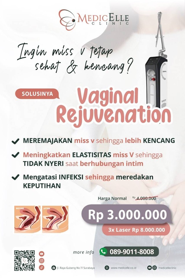 Ingin Miss V Sehat dan Kencang, Laser Vagina Rejuvenation Solusinya ...