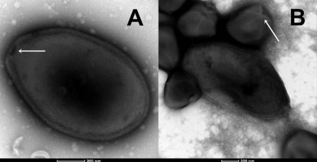Virus Purba yang Membeku 48.500 Tahun Hidup Kembali, Apakah Berbahaya ...