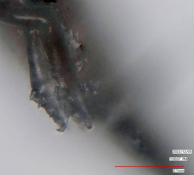 Ngeri! Tungau Demodex Ditemukan Bersarang di Bulu Mata Pria, Begini ...