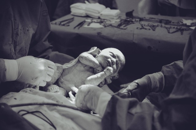 Kenali Bentuk Ari-Ari Bayi dan Fakta Menariknya | kumparan.com