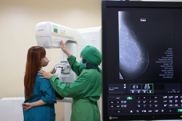 Mammografi 3D, Teknologi Terkini untuk Deteksi Dini Kanker Payudara ...