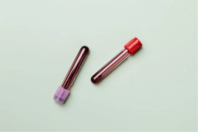 SGOT SGPT Normal Berapa Nilainya? Ini Jawabannya | kumparan.com