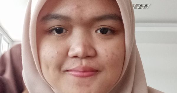 Konten dari Rania Arfath - kumparan