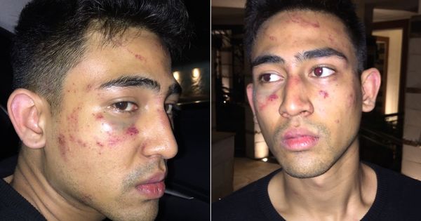 Axel Matthew Thomas: Berita Axel Matthew Thomas Terbaru dan Terupdate - kumparan