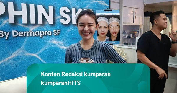 Amanda Manopo Ungkap Tudingan Operasi Plastik Berdampak Buruk pada ...