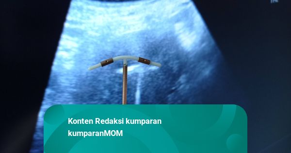 Kenali Tanda-tanda Tidak Cocok Pakai KB IUD Copper T | kumparan.com