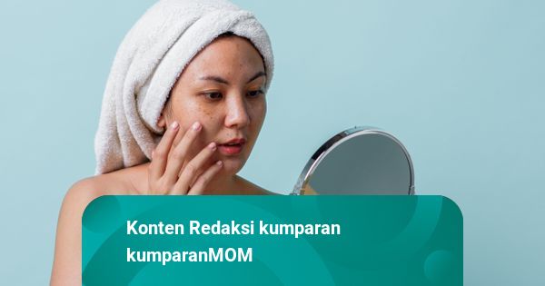 Kata Ahli: Cara Cegah Melasma saat Hamil | kumparan.com
