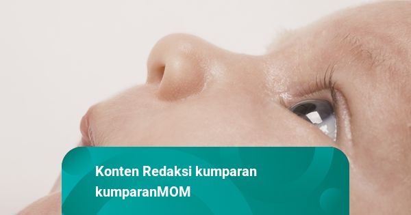 Bayi Bintitan, Ini Penyebab dan Cara Mengobatinya | kumparan.com