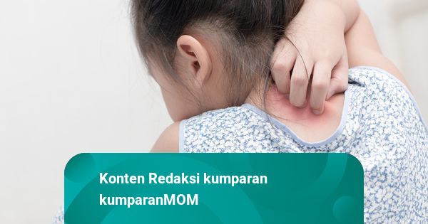 Tanda-tanda Anak Gatal karena Digigit Tungau dan Cara Menyembuhkannya ...