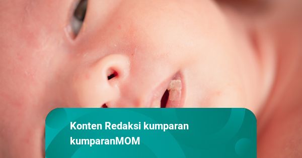 Bibir Bayi Baru Lahir Berubah Warna Jadi Kebiruan, Apa Penyebabnya ...