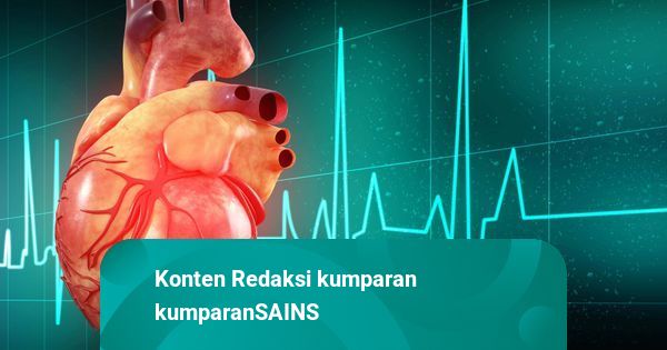 Mengenal Penanganan Atrial Fibrillation Lewat Teknik Ablasi Jantung ...