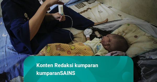 Gilang Andika, Bayi Asal Batam yang Lahir dengan 2 Wajah | kumparan.com