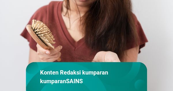 Waspada, Rambut Rontok Bisa Jadi Gejala Penyakit Sifilis | kumparan.com