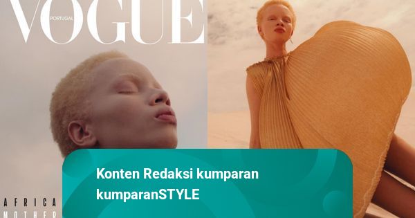 Thando Hopa, Model Albino Pertama di Cover Majalah Vogue | kumparan.com