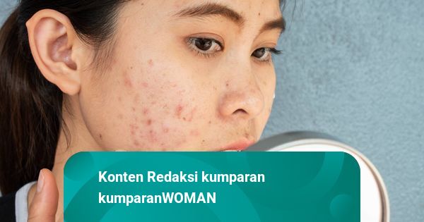 5 Masalah Kulit Wajah Akibat Stres, dari Peradangan hingga Mudah ...