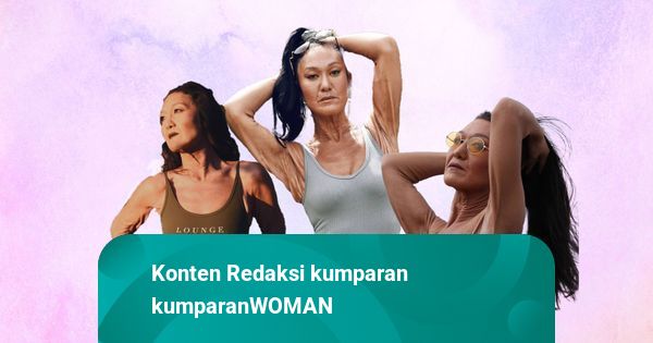 Kisah Inspiratif Sara Geurts, Model 31 Tahun yang Kulitnya Dipenuhi ...