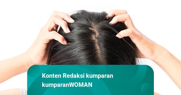 3 Cara Menghilangkan Telur Kutu Rambut dalam 1 Hari Menggunakan Bahan ...