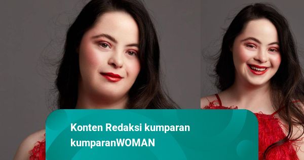 Kisah Ellie Goldstein, Perempuan Down Syndrome yang Jadi Model Sampul ...