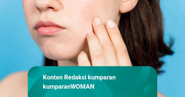 Ciri-Ciri Kulit Kombinasi dan Bahan Skincare yang Direkomendasikan ...